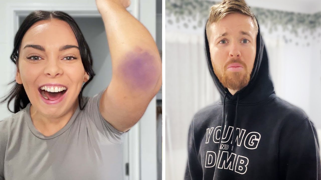 Broken Arm Prank - YouTube