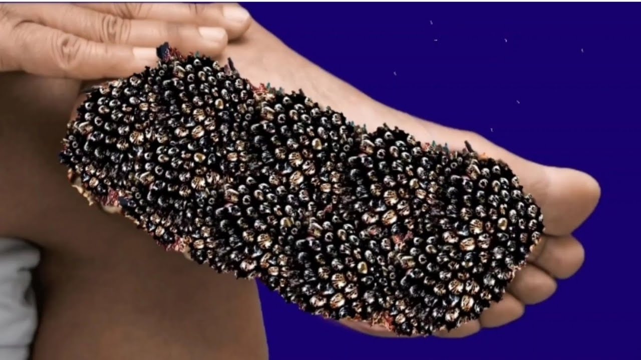 ASMR Remove Maggots From Infected Hand & Foot | ASMR 2D Animation ...