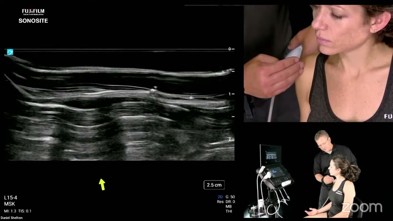 Diagnostic Shoulder Ultrasound: Part 1 - Anterior Shoulder - YouTube