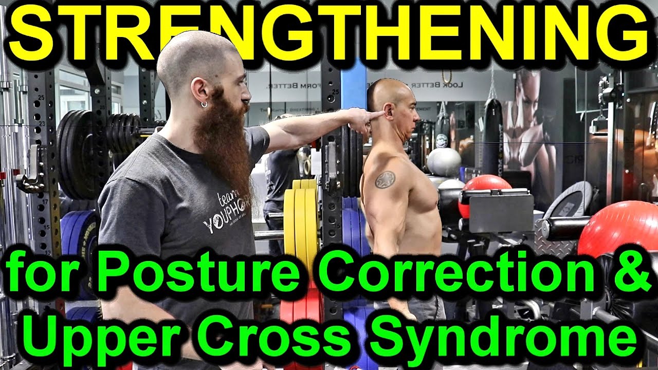 HOW TO CORRECT UPPER CROSS SYNDROME: Top 5 Strengthening Exercises for ...