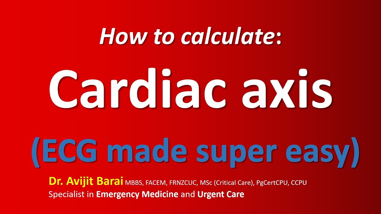 Cardiac axis deviation made super easy | Cardiac axis calculation - YouTube
