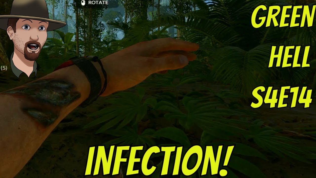 Unexpected Infection!- Green Hell S4E14 - YouTube