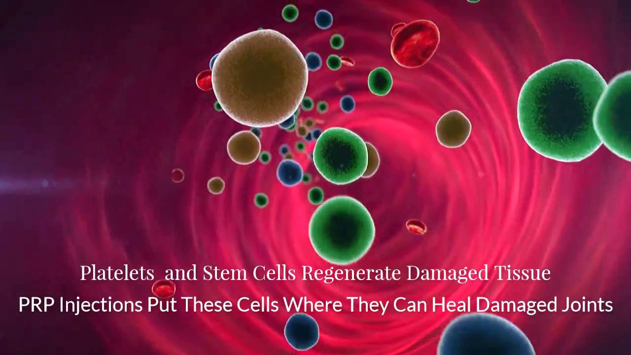 PRP Stem Cell Regeneration Injections - YouTube