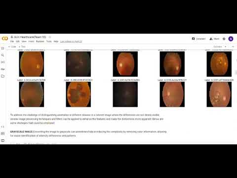 Diabetic retinopathy using machine learning (python) on Google collab ...