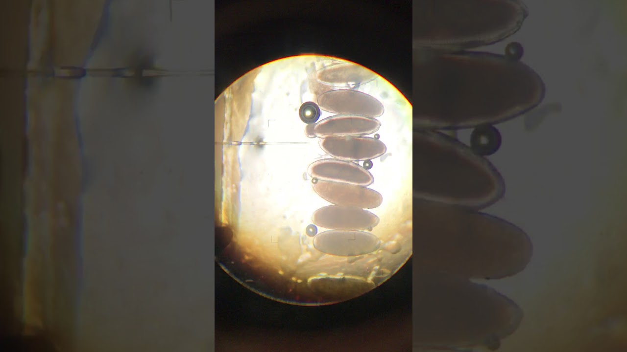 Drosophila Injections - YouTube