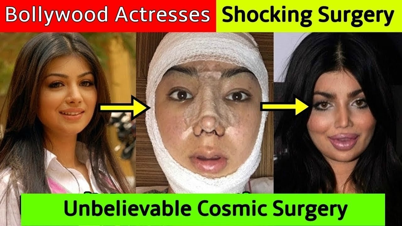 8 Bollywood Actresses Plastic Surgery Gone Wrong | Then And Now - YouTube