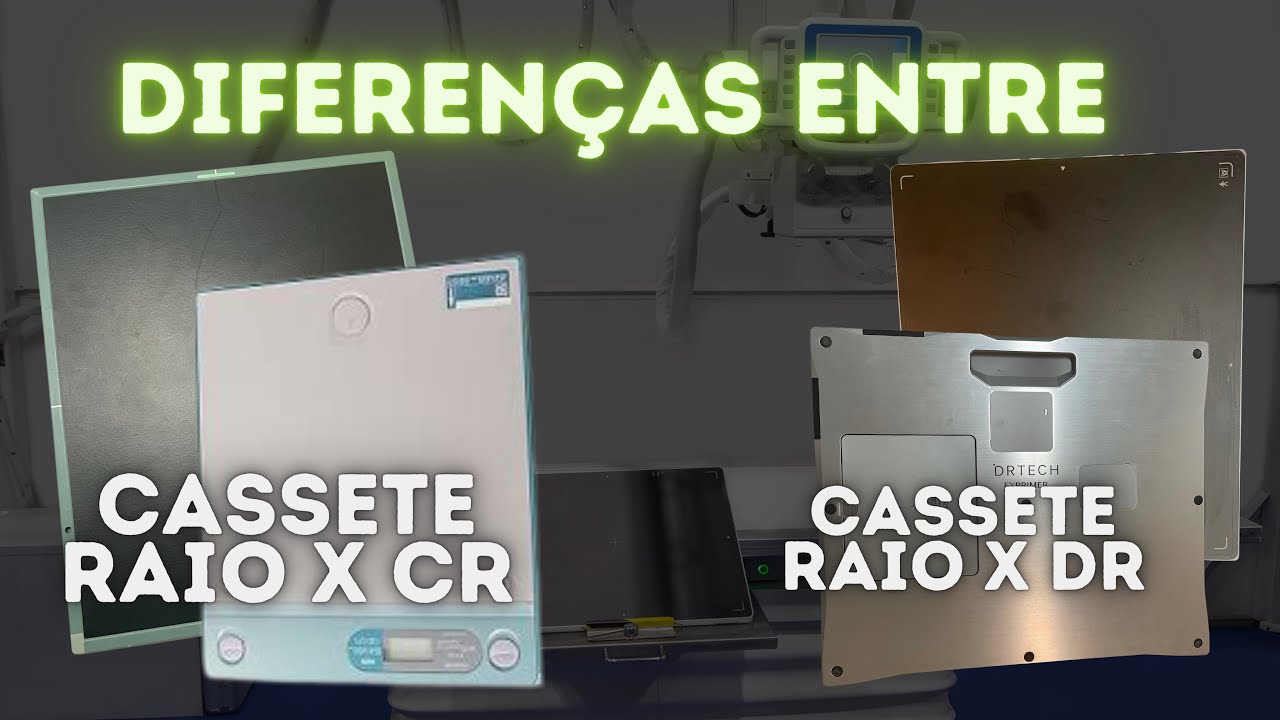 Diferença entre Chassis sistema DR comparado ao CR. #radiologia - YouTube