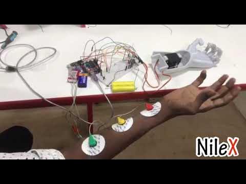 Designing a 3D-printed EMG bionic hand as a low-cost alternative to ...