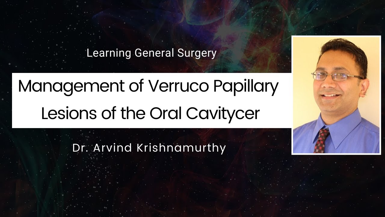 Management of Verruco Papillary Lesions of the Oral Cavity |Dr. Arvind ...