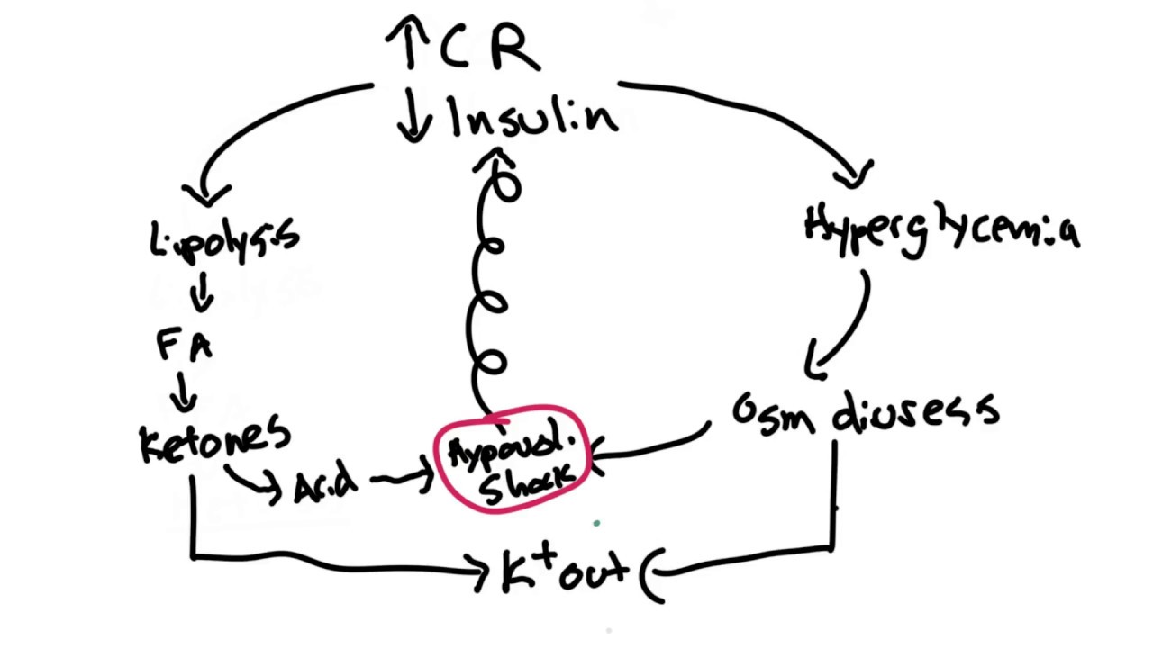 DKA Physiology Explained - YouTube