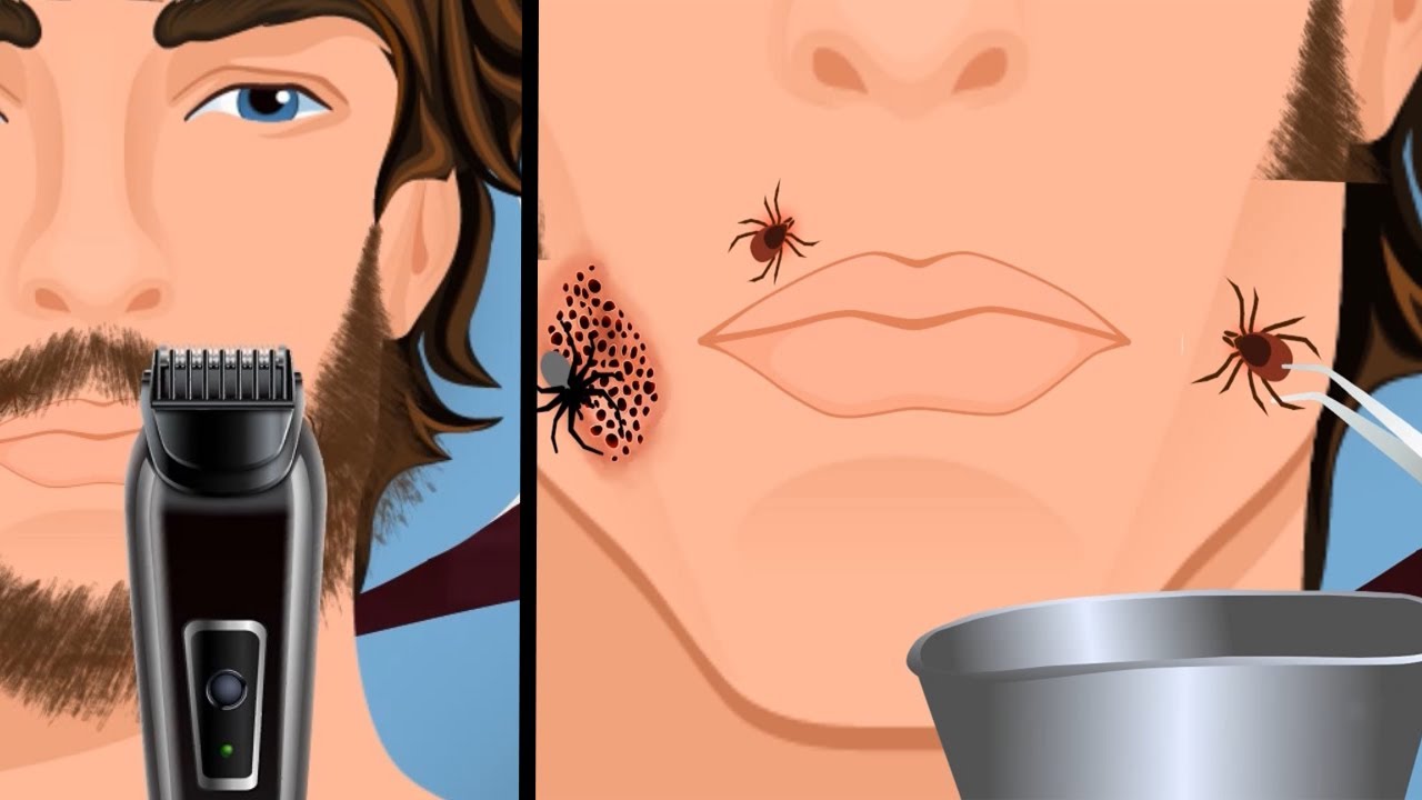 Satisfying beard shaving ASMR video | Ticks and spider removal | insect ...