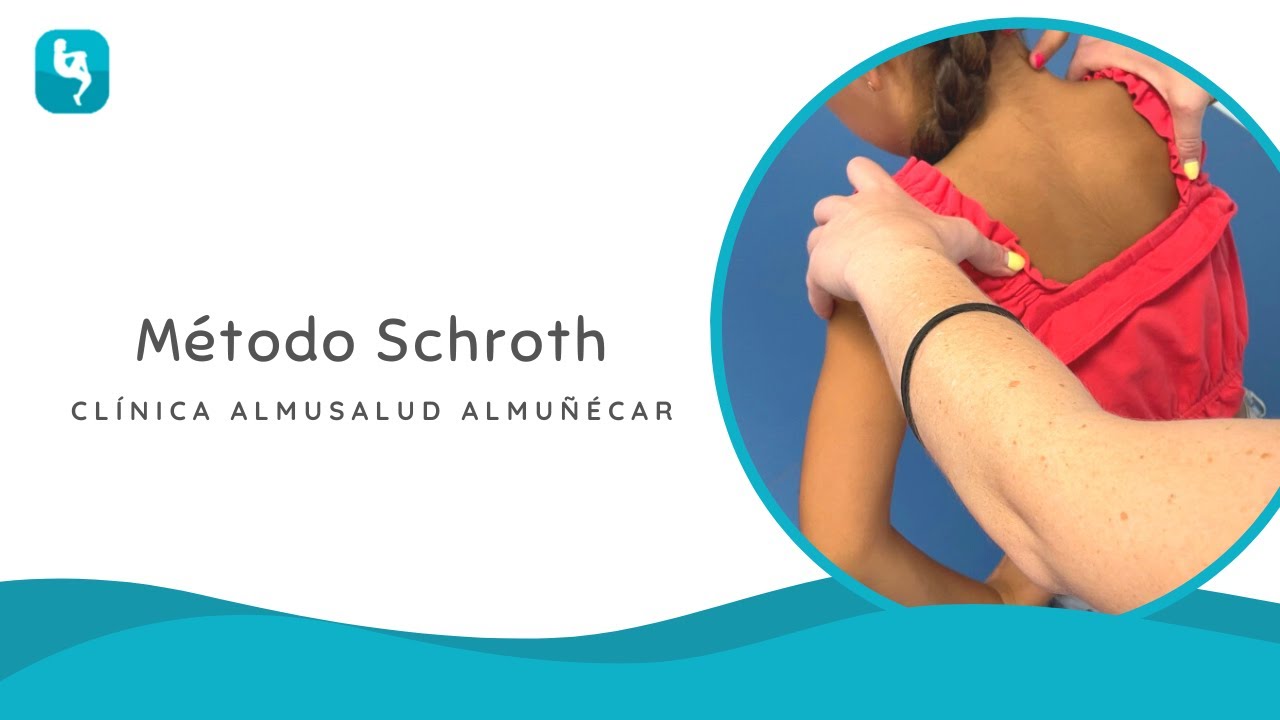 Método Schroth. ¿Cómo tratar la #escoliosis? Clínicas Almusalud - YouTube