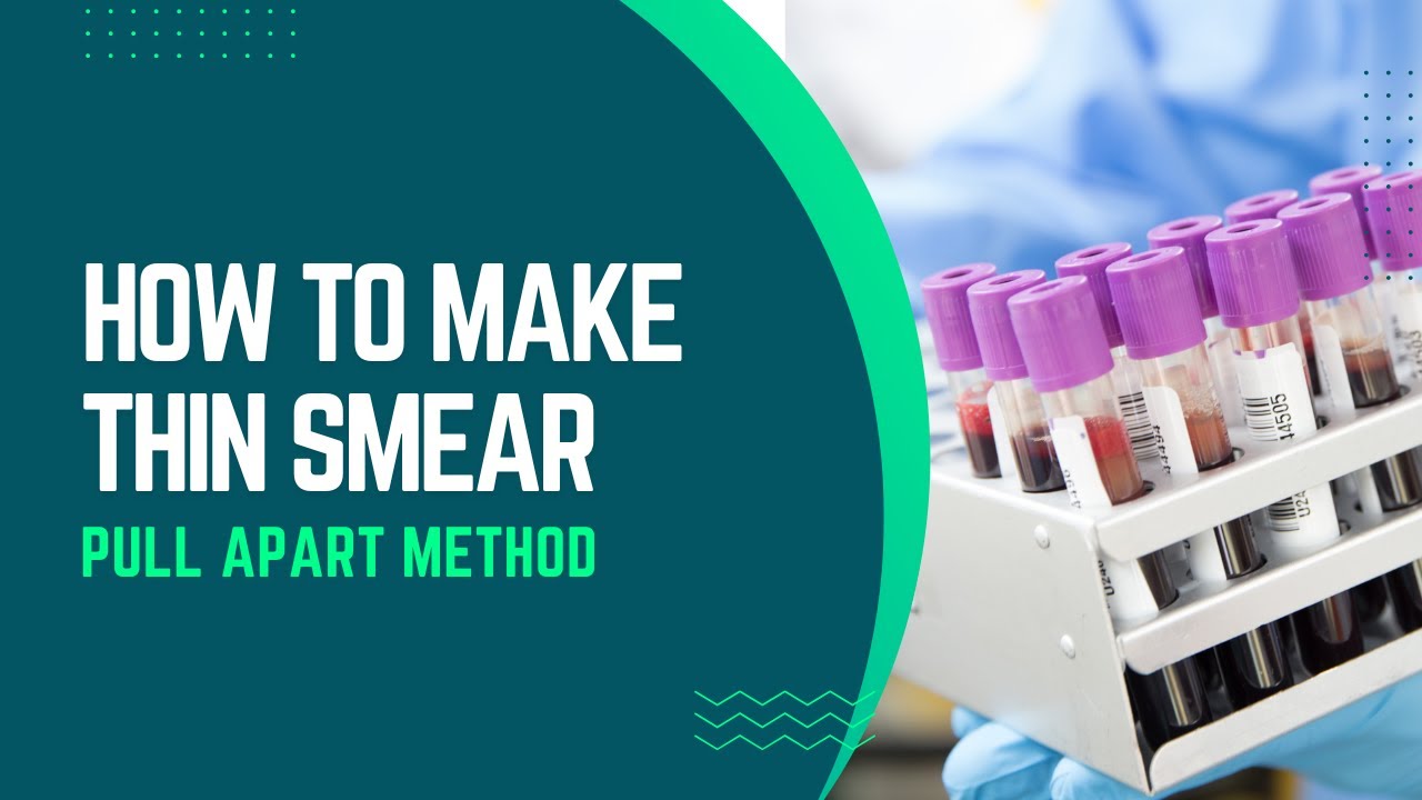 Perfect Blood Smear Using Pull-Apart Method | MLT Practical Made Easy ...