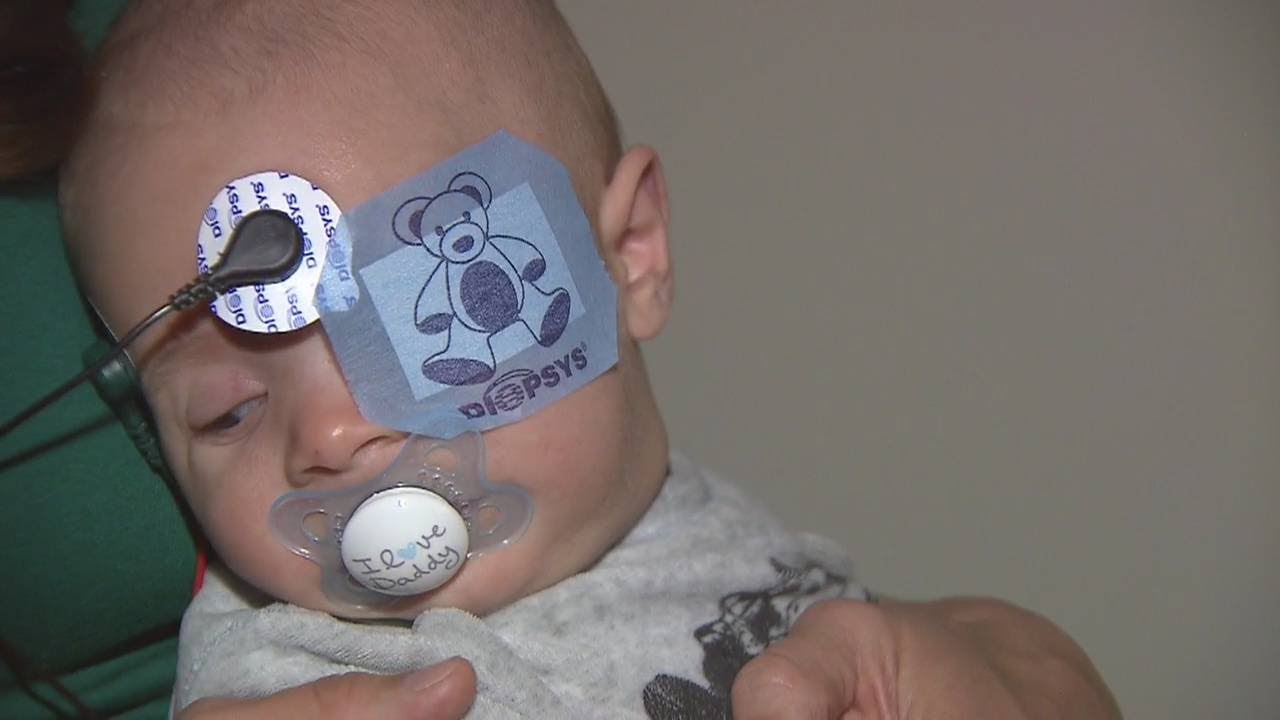 How to detect visual impairment in young children - YouTube