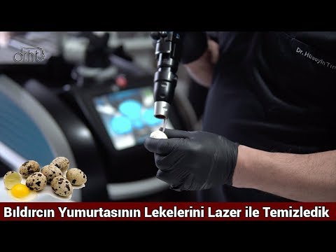 BILDIRCIN YUMURTASININ LEKELERİNİ LAZER İLE TEMİZLEDİK..