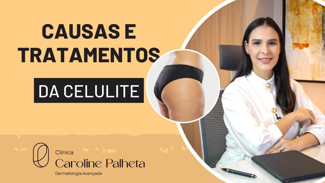 CAUSAS E TRATAMENTOS DA CELULITE - YouTube