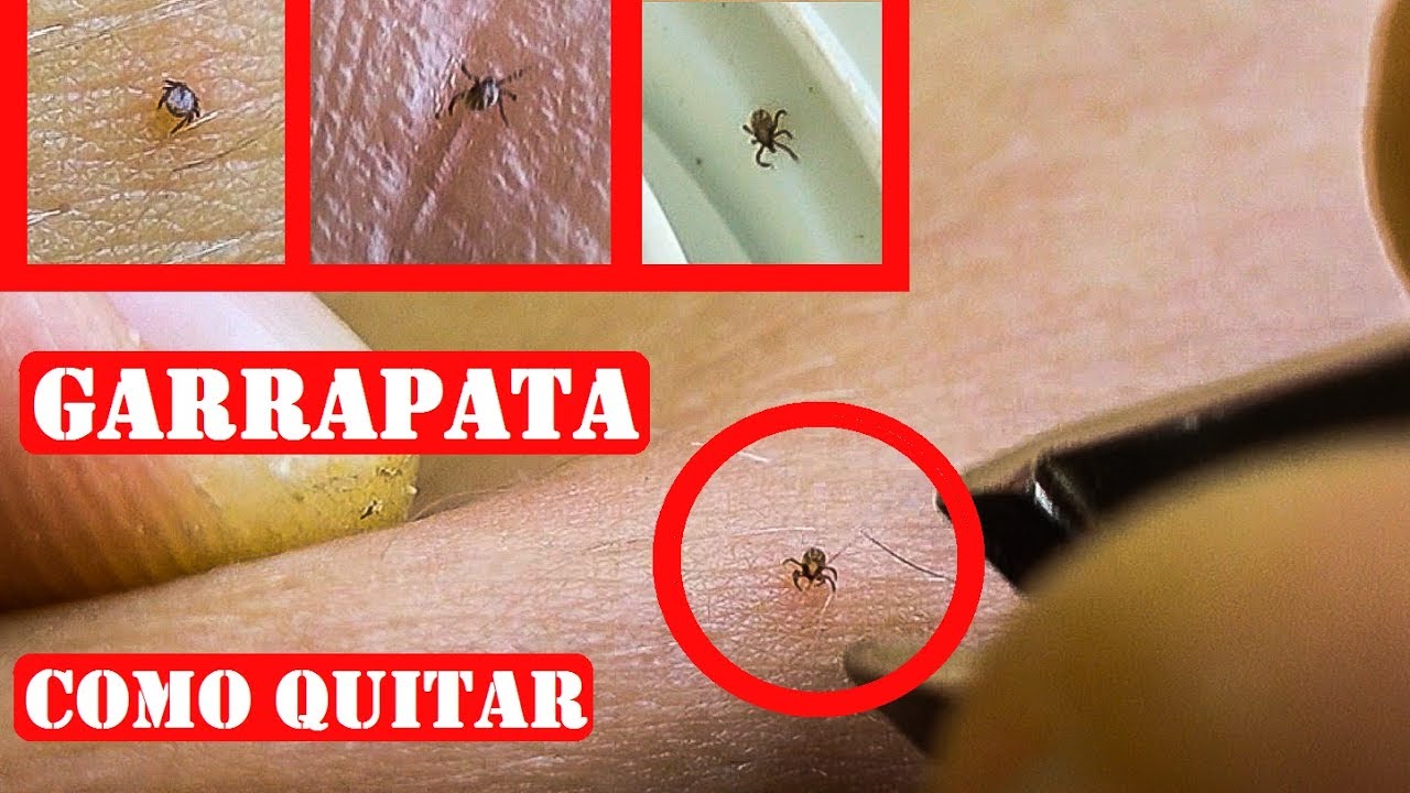 Que Pasa Si La Cabeza De Una Garrapata Se Queda En El Perro