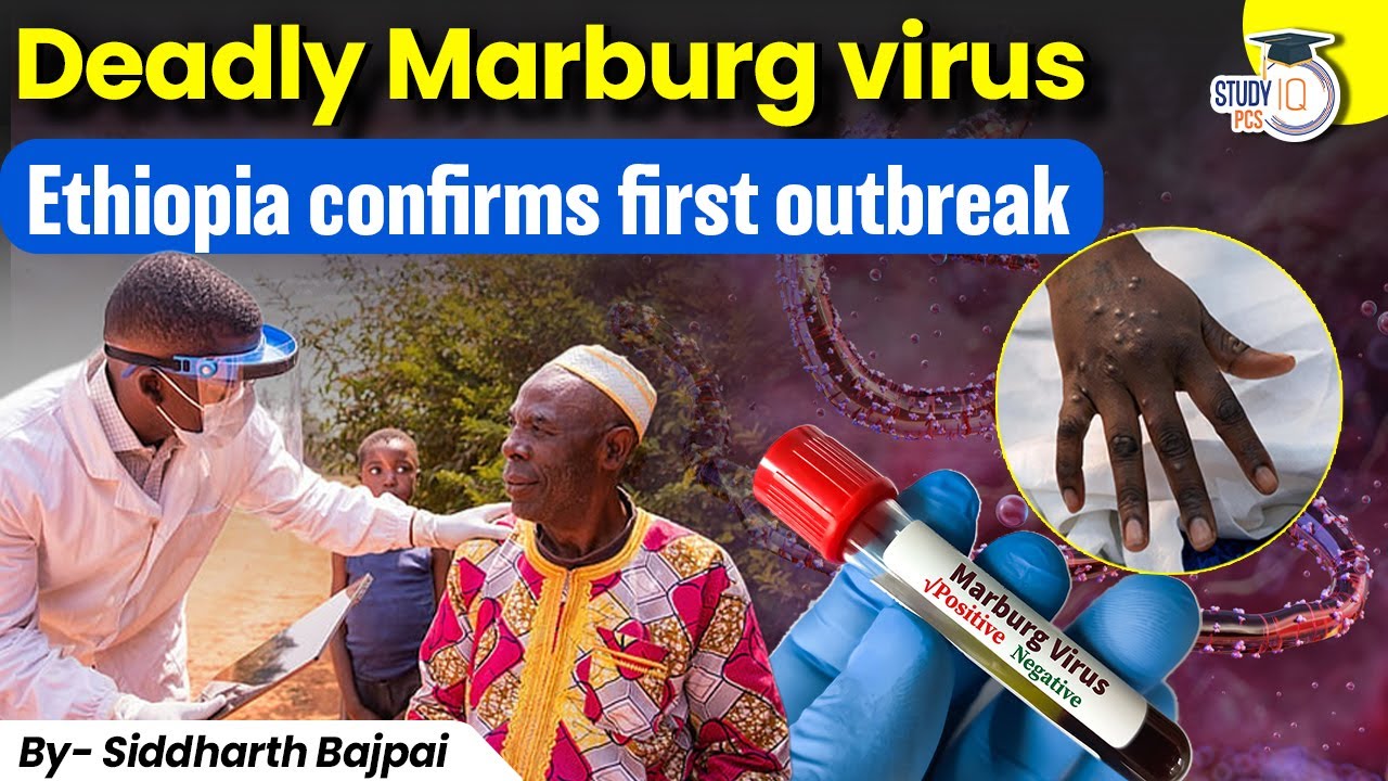 Deadly Marburg Virus Emerges in Ethiopia — Symptoms & Dangers Explained ...