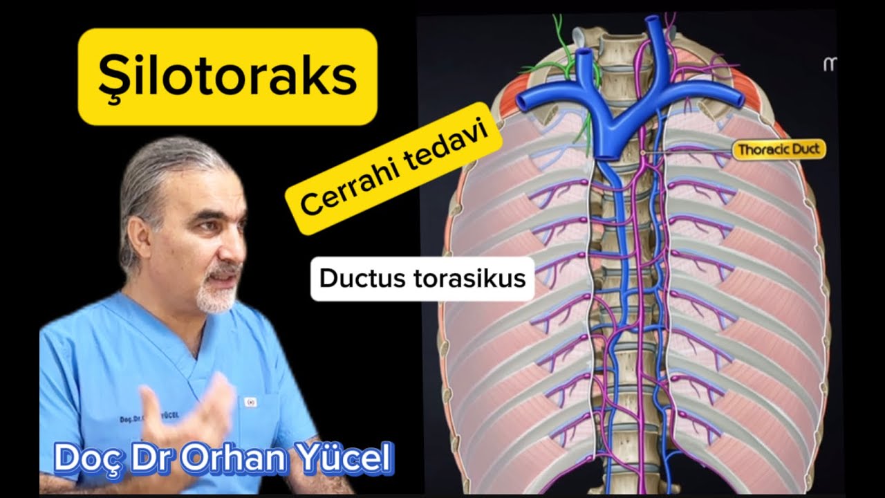 Şilotoraks ve Duktus Torasikus: Nasıl Tedavi Edilir? - YouTube
