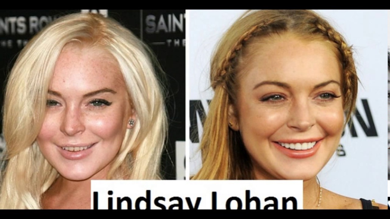 13 Fake Teeth Celebs Before And After - YouTube
