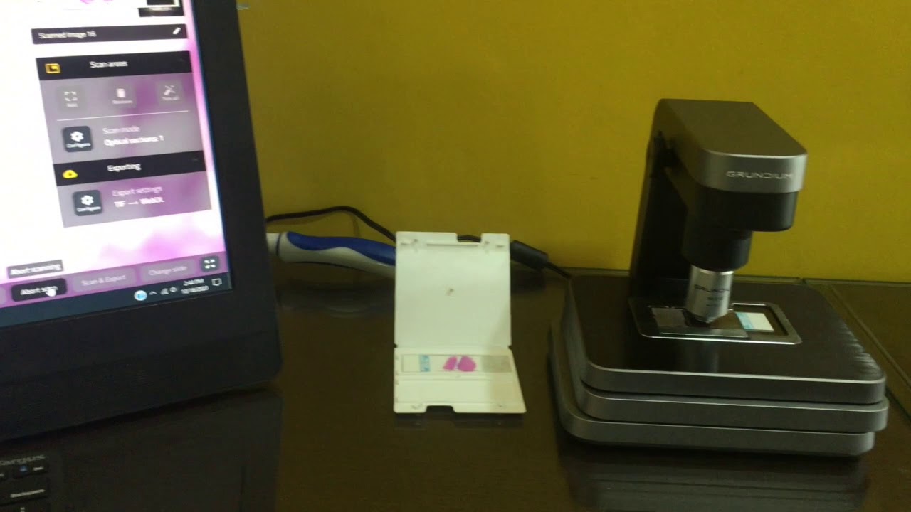 Grundium Ocus20 Digital microscope in action. - YouTube