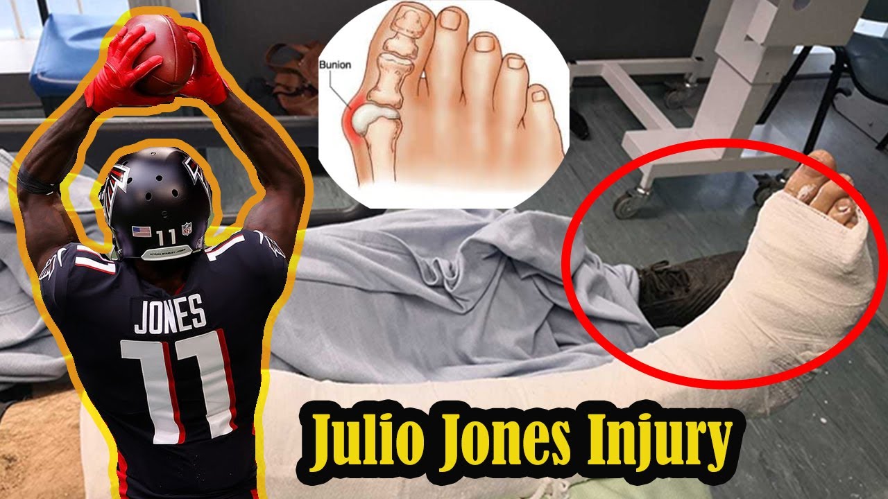Julio Jones Injury