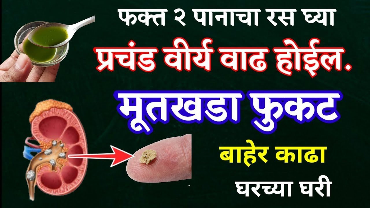 मुतखडा ऑपरेशन करण्यापुर्वी हा उपाय करा,किडनी स्टोन गळेल,जोश रात्रभर ...