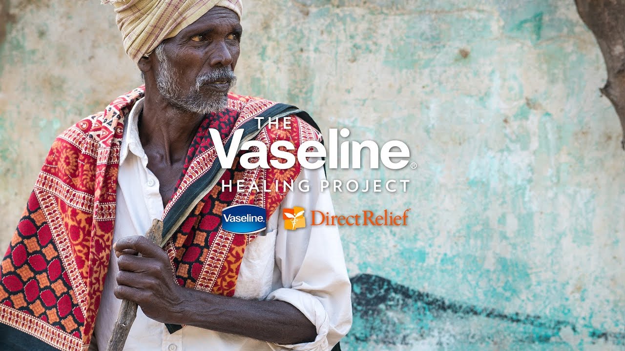 The Vaseline Healing Project - India - YouTube