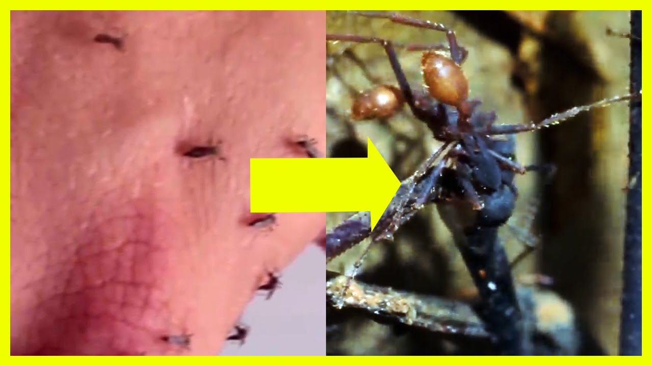 TOP 5 INSECTOS MÁS PELIGROSOS Y MORTIFEROS DEL PLANETA! *TEN MUCHO ...