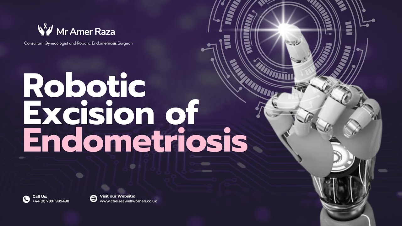 Robotic Excision of Endometriosis - YouTube