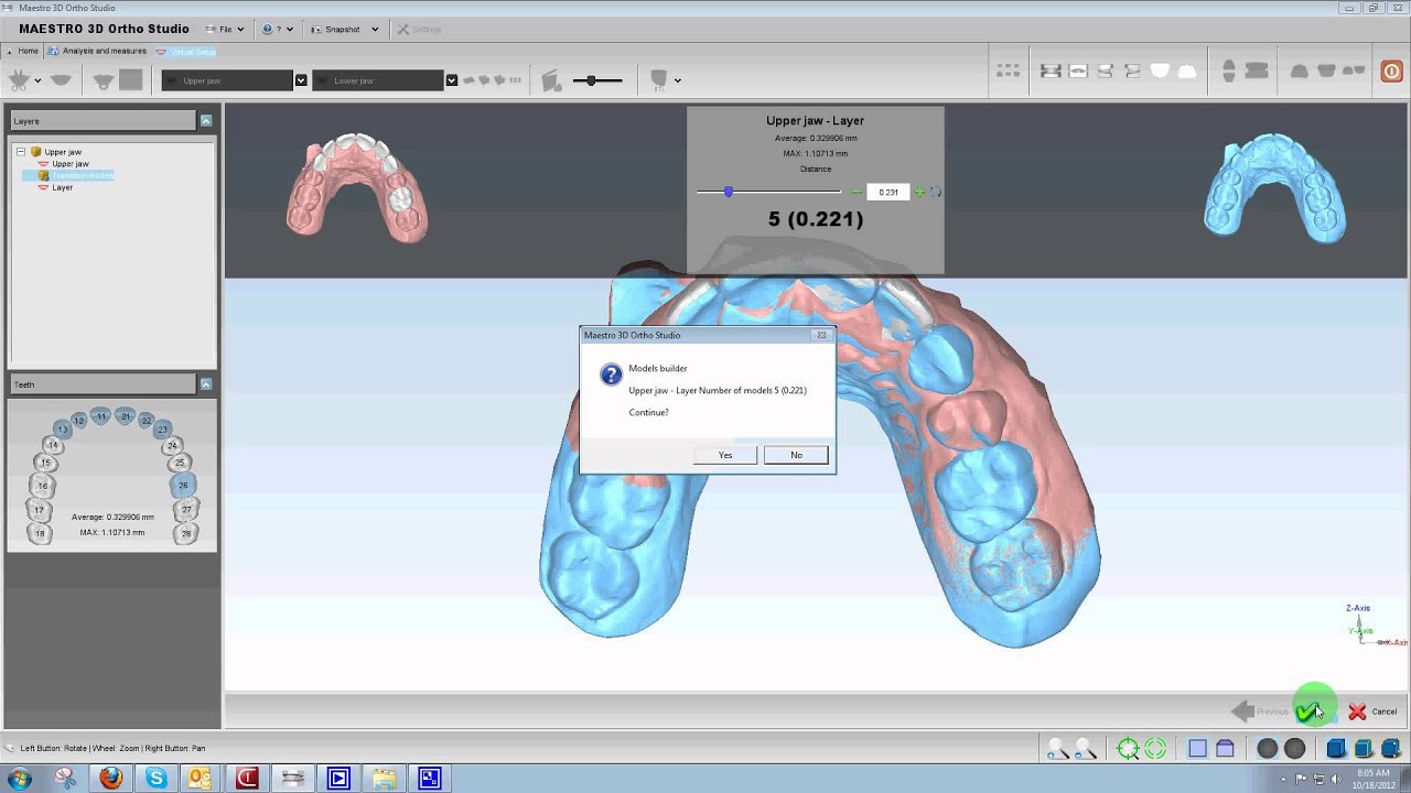 Ortho Studio - Part 9. Model builder - YouTube
