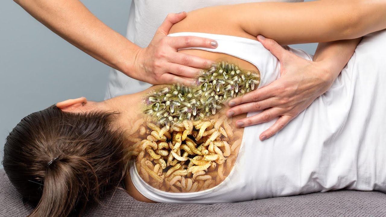 Surgeon Simulator 2 -ASMR Removes Large Pustules & Parasitic Maggots on ...