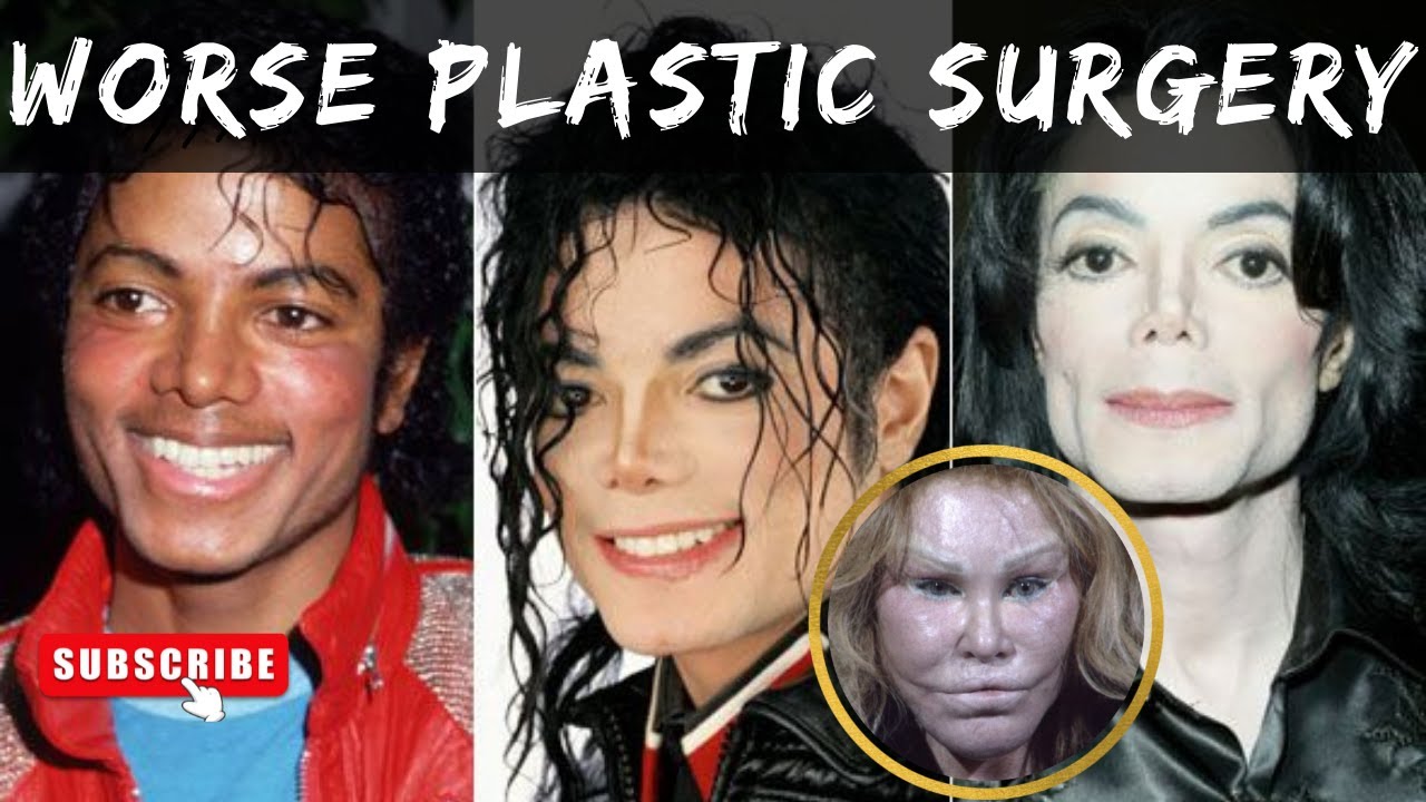 CELEBRITY PLASTIC SURGERY DISASTER | Top 10 Celebrity Plastic Surgery ...