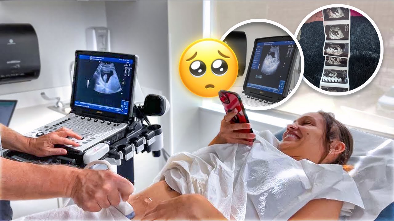 FIRST Ultrasound + Hearing The HEARTBEAT *emotional* - YouTube