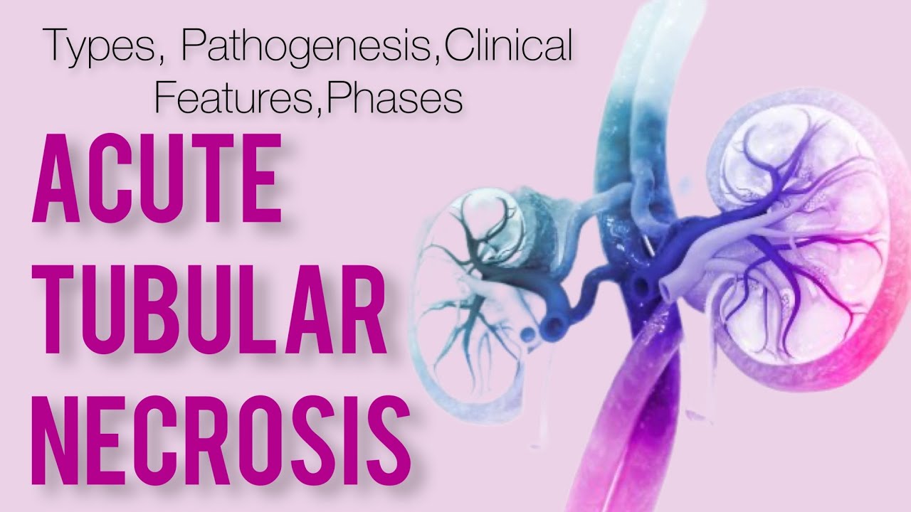 Acute Tubular Necrosis | Types | Pathogenesis | Clinical Features ...