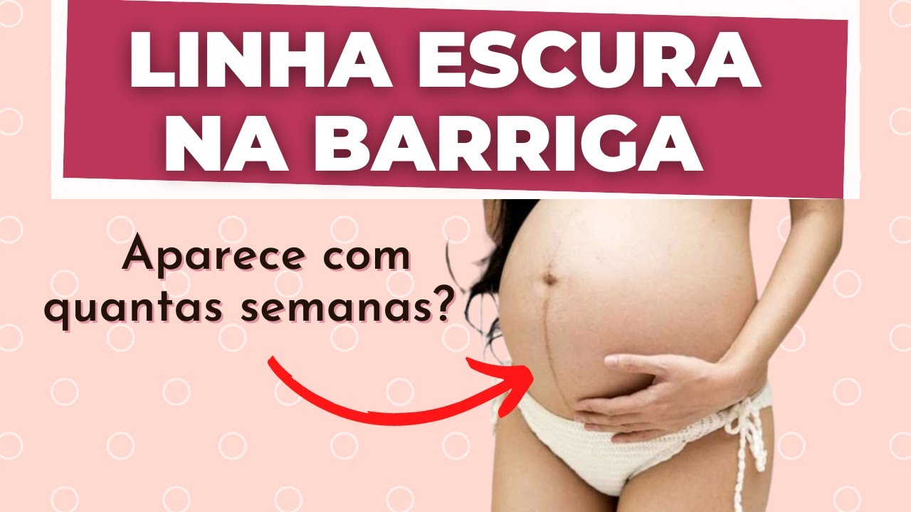 LINHA NIGRA OU ESCURA APARECE COM QUANTAS SEMANAS ? OQUE QUER DIZER | some depois? - YouTube