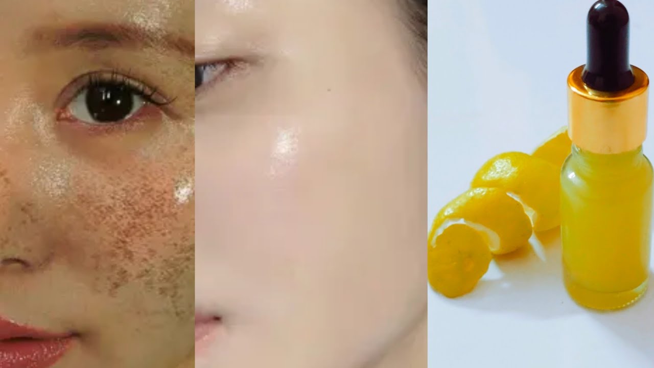 Lemon face serum and cream for pigmentation and dark spots | Skin care ...