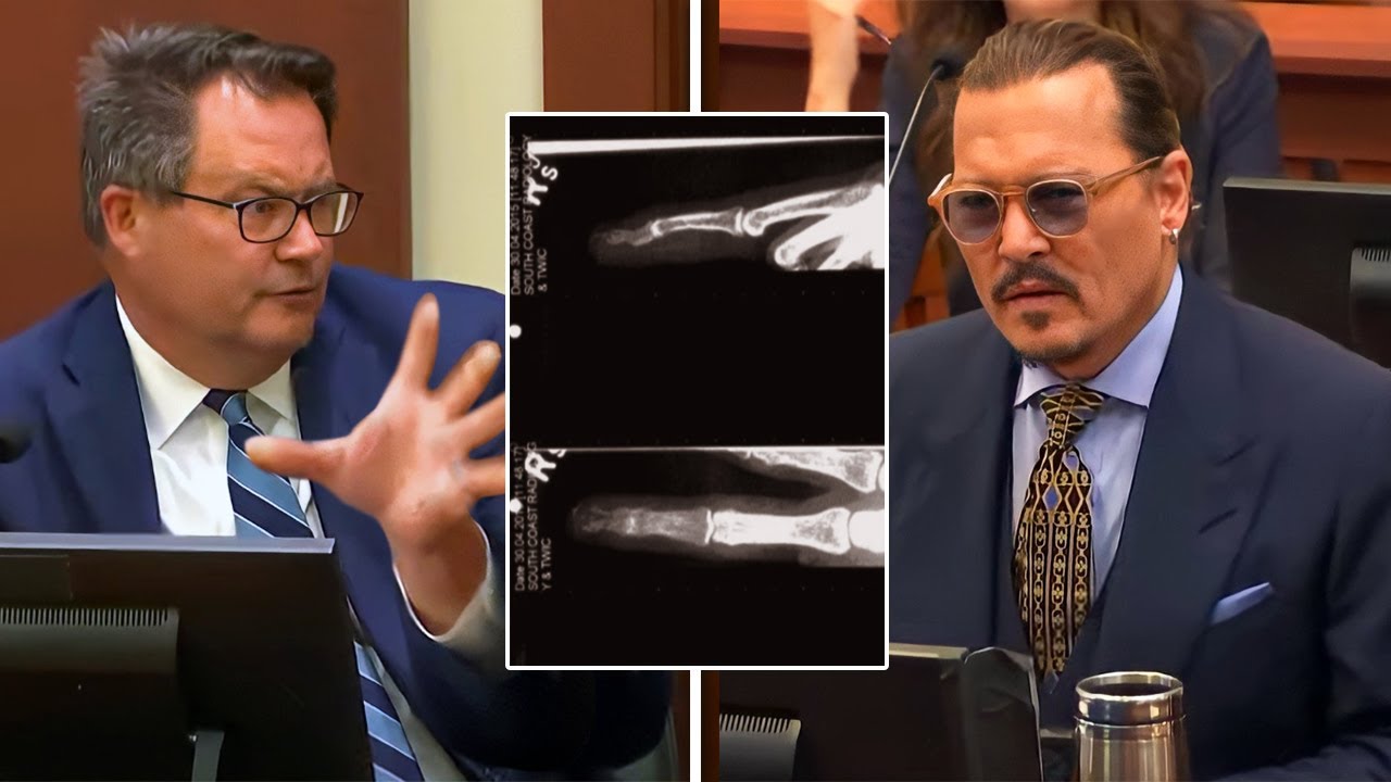 Finger Surgeon Actually APPROVES Johnny Depp’s Story! - YouTube