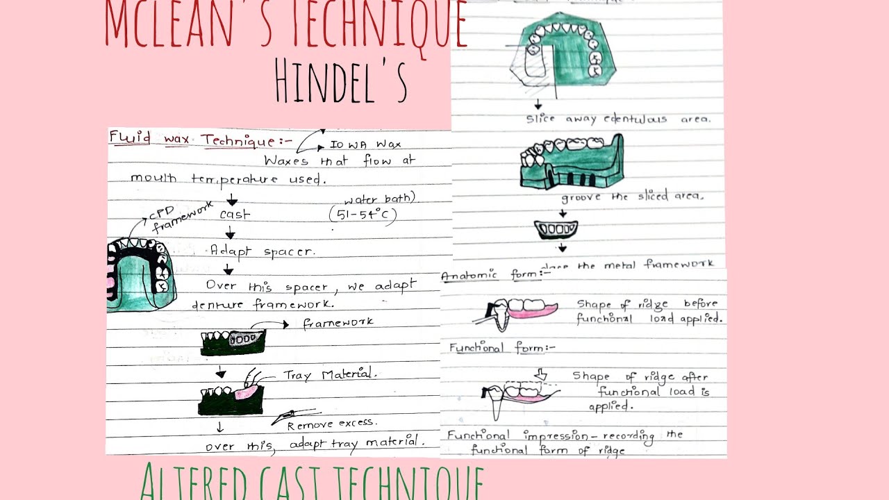 Mclean's Technique|| Functional Dual Impression||Secondary impression ...