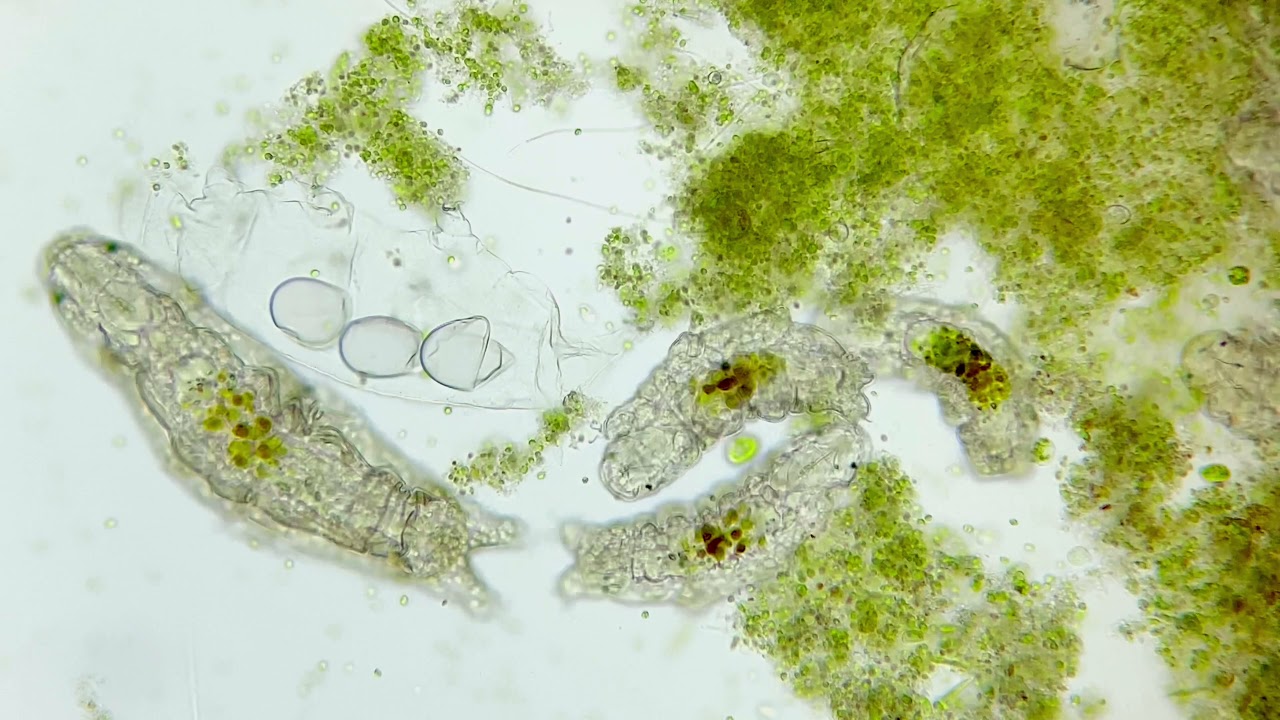 Tardigrade Under Microscope