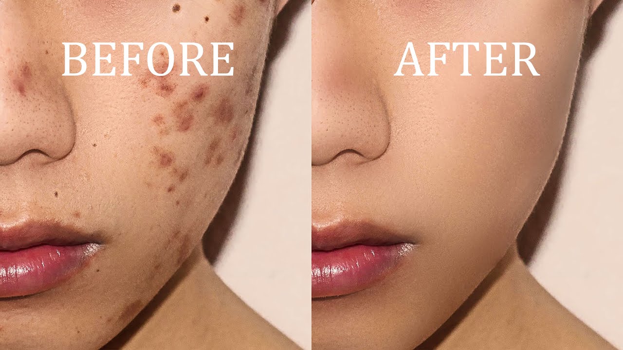 How To Remove Blemishes In Photoshop Free Frequency Separation Action YouTube how-to-remove-blemishes-in-photoshop-free-frequency-separation-action-youtube
