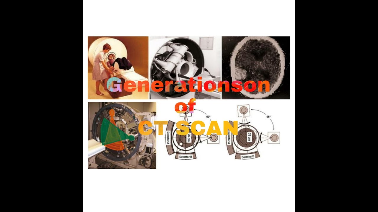 Generations of Ct Scan | Radiology | Hariaheco | Loksewa exam - YouTube