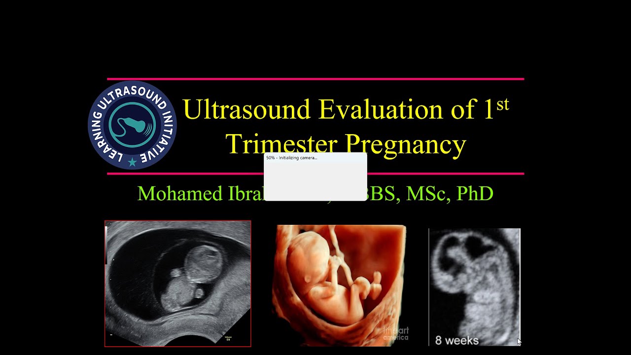 First trimester ultrasound-Normal - YouTube