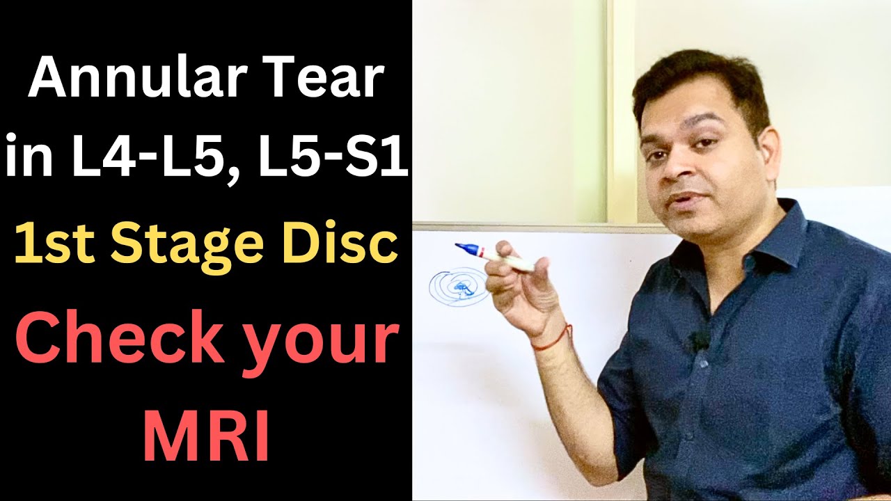 What is Annular Tear, Disc Bulge L4-L5, Slipped Disc, Lumbar Spine MRI ...