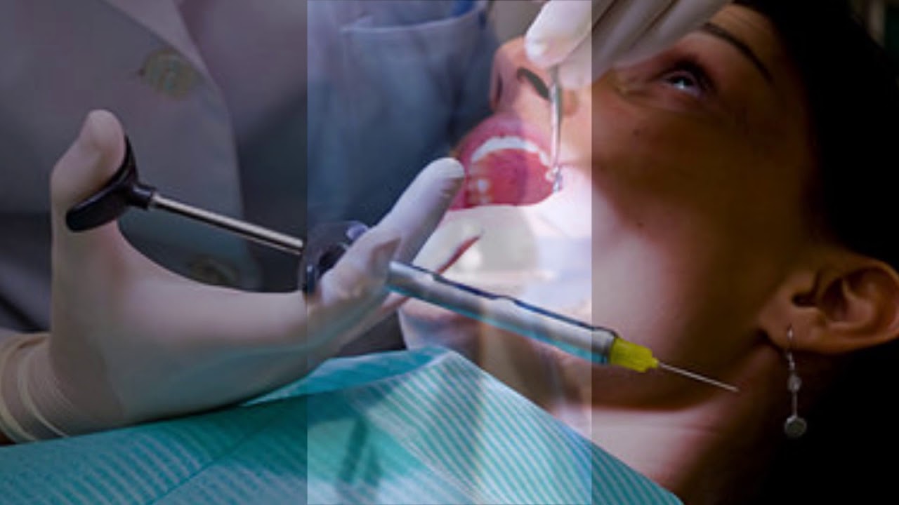 Bloqueo del nervio Mentoniano e intraligamentaria - YouTube