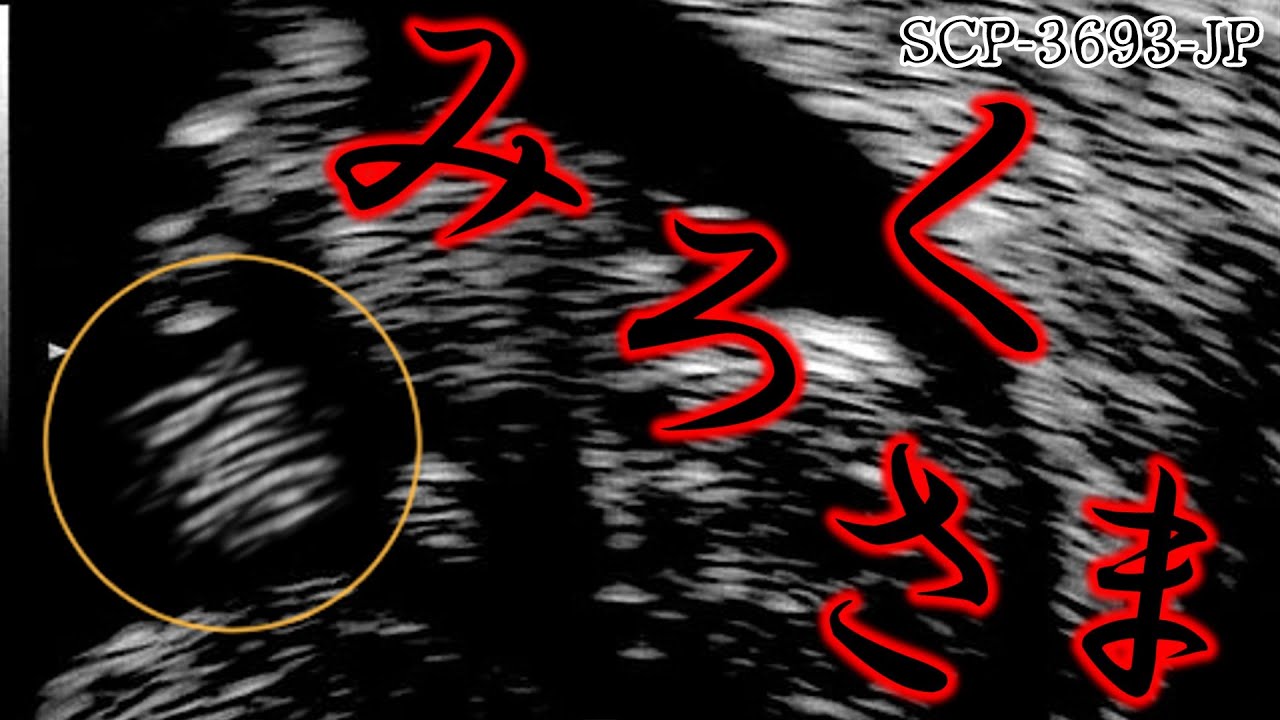 【ゆっくり解説】少し閲覧注意。 が人間に寄生？その理由は… SCP-3693-JP みろくさま - YouTube