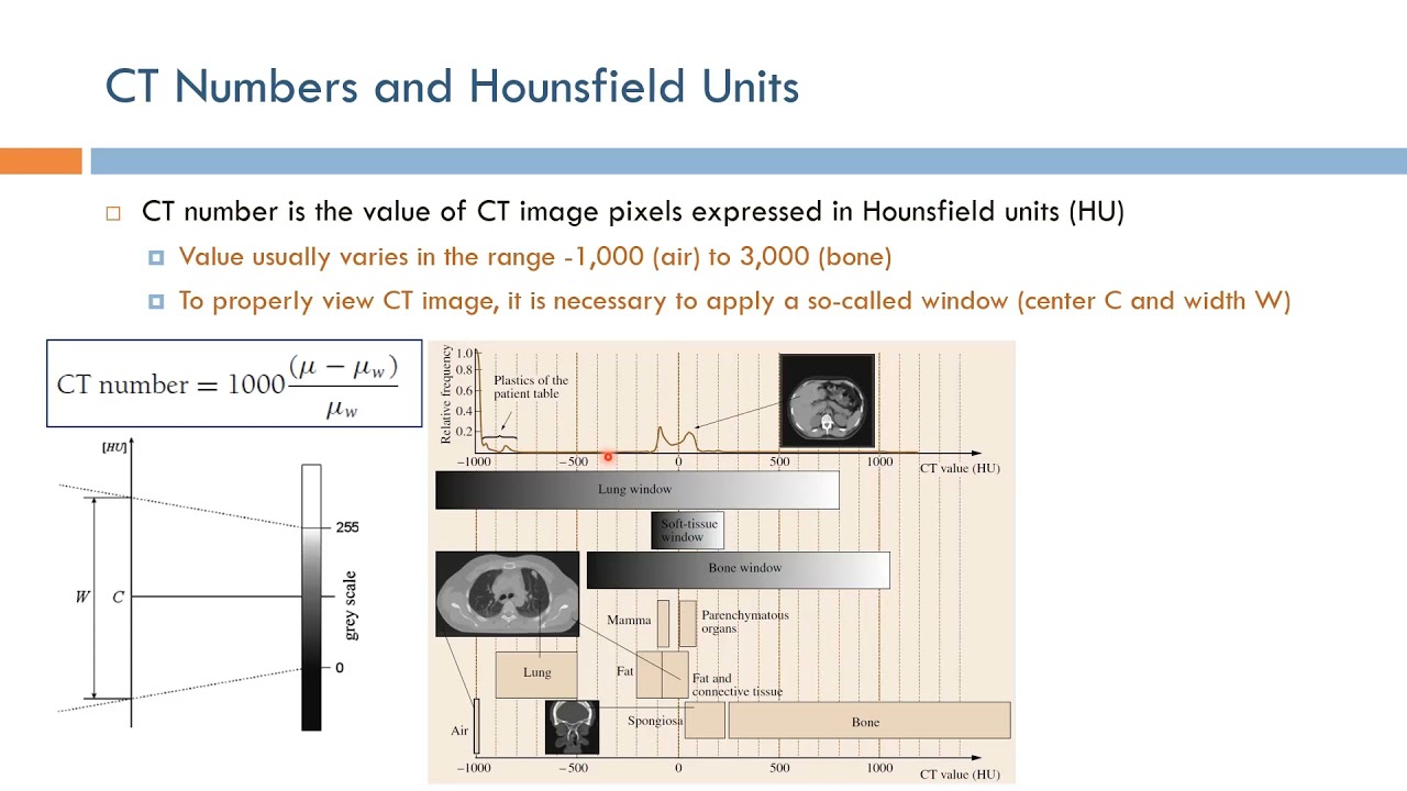 Short Topics in Computed Tomography: CT Numbers and Hounsfield Units ...