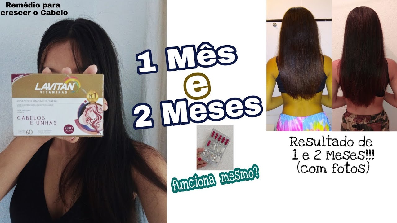 Lavitan Antes E Depois De 1 E 2 Meses De Uso Meu Cabelo Cresceu