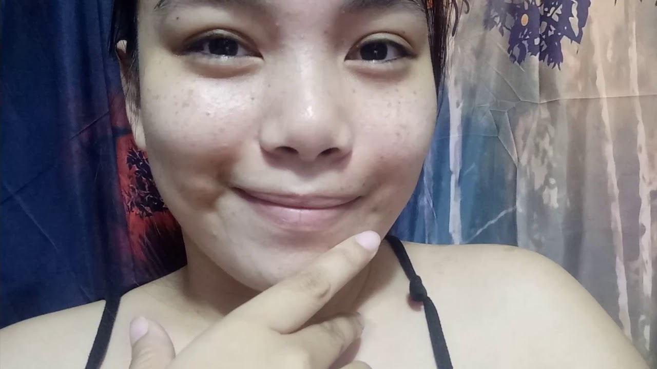 Swollen Face(Namamagang Mukha) day 5th and 6th - YouTube