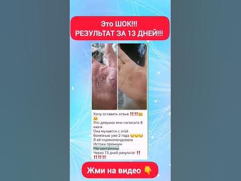 Мегавитамины для сильного имунитета от Сибирского здоровья #сибирское ...